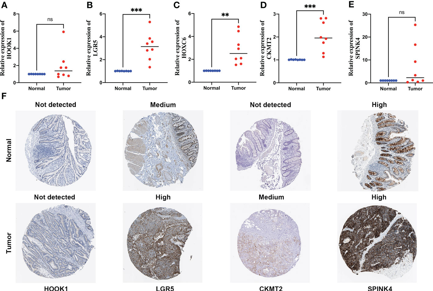 Frontiers Identification Of Cuproptosis Based Molecular Subtypes