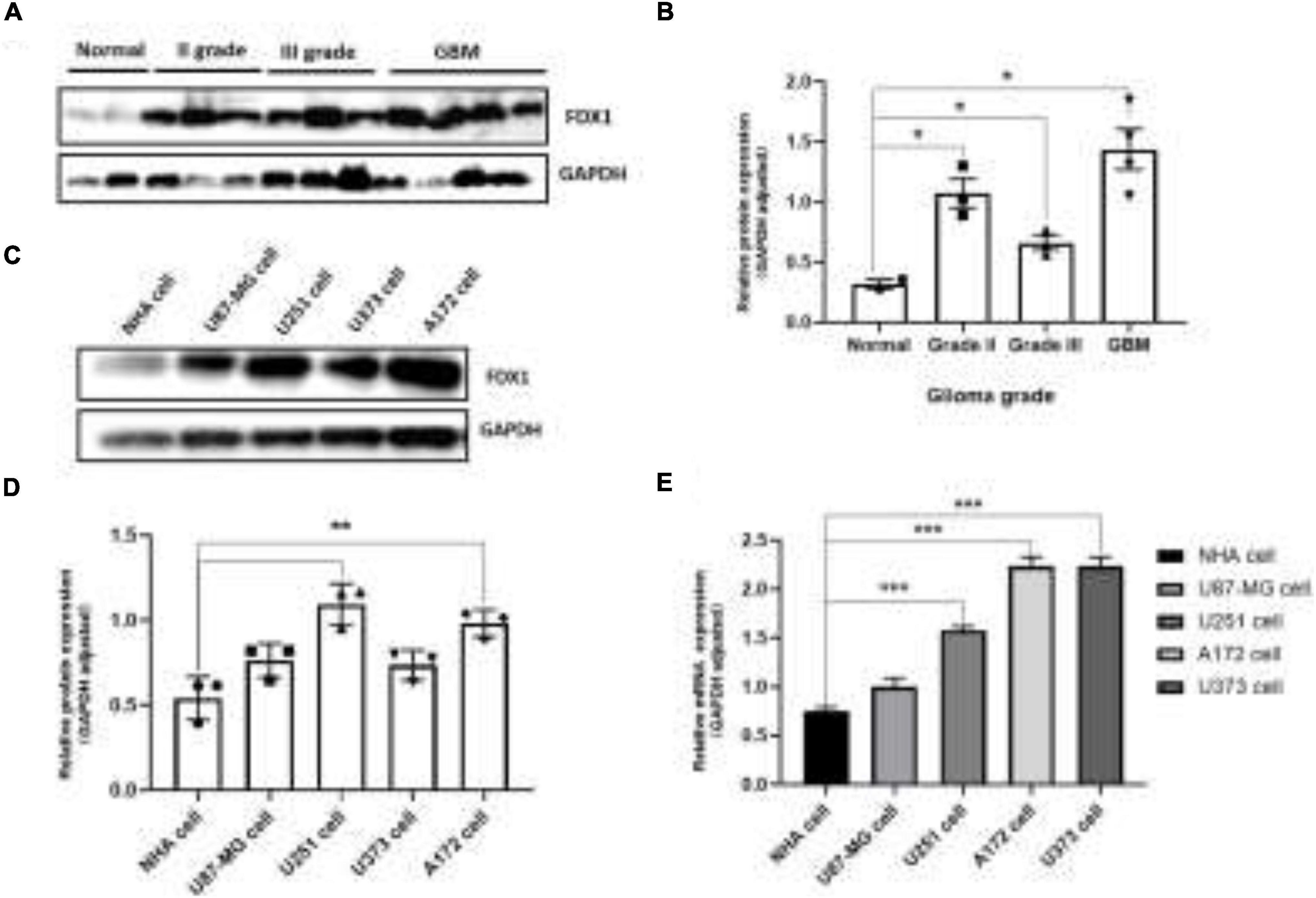Frontiers | Cuproptosis key gene FDX1 is a prognostic biomarker and associated with immune ...