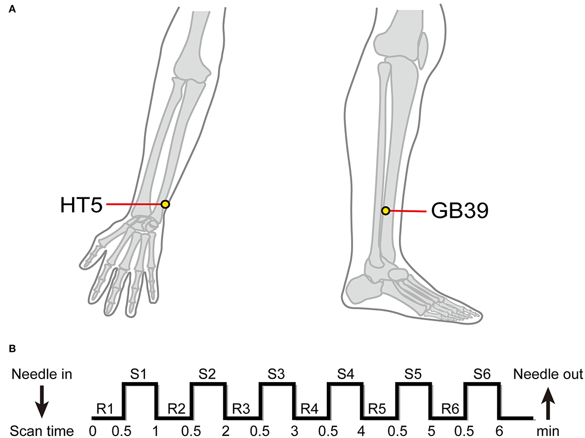 Frontiers Modulations Of Static And Dynamic Functional Connectivity