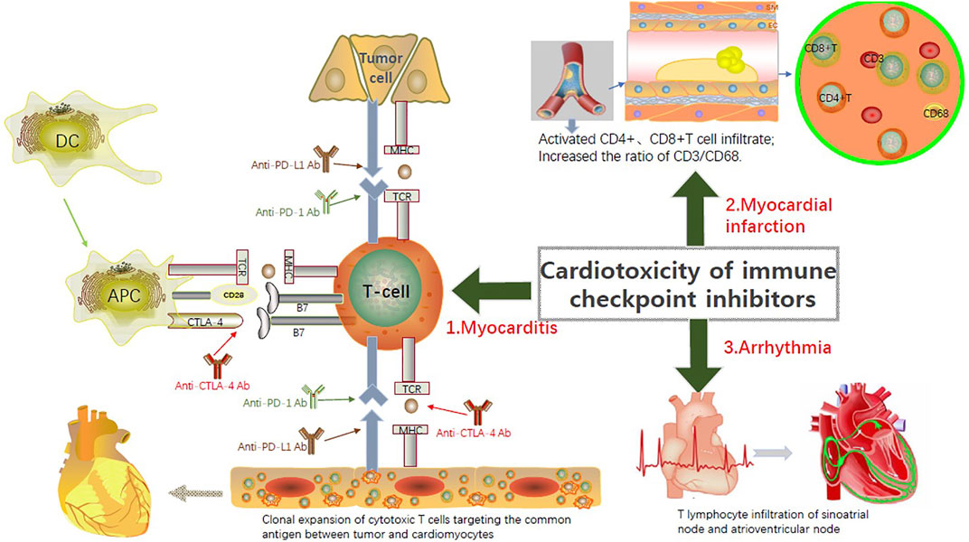Frontiers Cardiotoxicity Associated With Immune Checkpoint Inhibitors