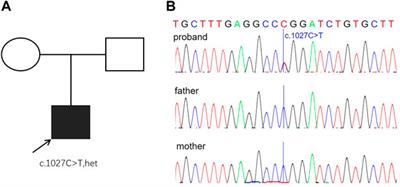 Frontiers | Case report: Prenatal diagnosis of Ectrodactyly–Ectodermal ...