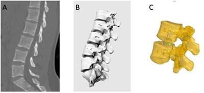 Frontiers | The 6 degrees-of-freedom range of motion of the L1–S1 ...