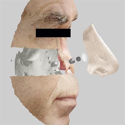 Frontiers | Present and future of extraoral maxillofacial ...