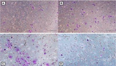 Frontiers | Factors released by low and high-LET irradiated fibroblasts ...