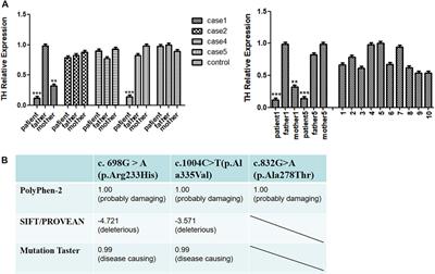 Frontiers | Segawa syndrome caused by TH gene mutation and its mechanism