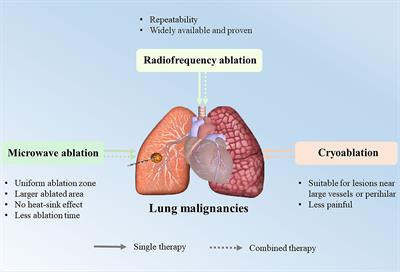 Frontiers | Image-guided percutaneous ablation for lung malignancies