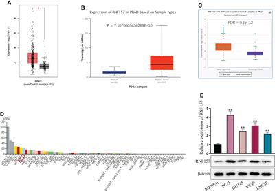 Frontiers | Exosomal RNF157 mRNA from prostate cancer cells contributes ...