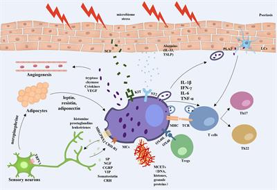Frontiers | Mast cells as important regulators in the development of ...