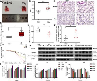 Frontiers | Protein-protein interactions between RUNX3 and ZEB1 in ...