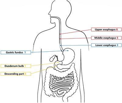 Frontiers | Endoscopic resection of upper gastrointestinal lymphangioma ...