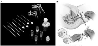 Frontiers | An emerging paradigms on cervical cancer screening methods ...