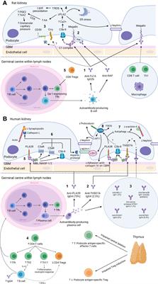 Frontiers | Membranous nephropathy: Clearer pathology and mechanisms ...