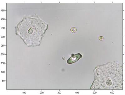 Frontiers | Cell image reconstruction using digital holography with an ...