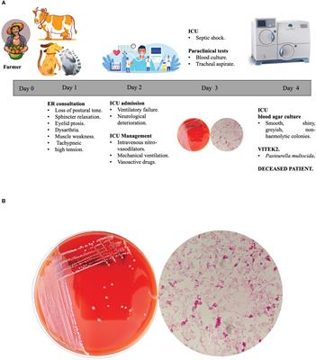 Frontiers | Case Report: Septic shock due to Pasteurella multocida in ...