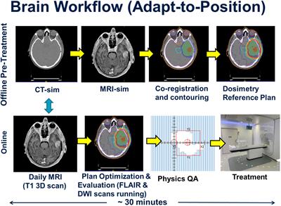 Frontiers | High grade glioma radiation therapy on a high field 1.5 ...