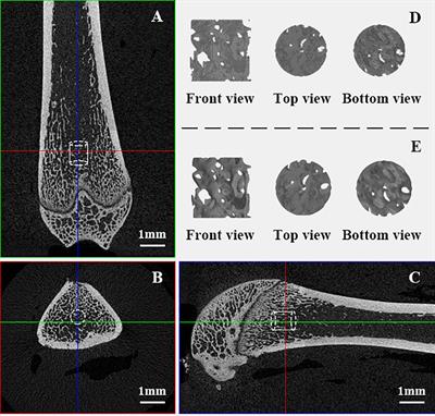 Frontiers | Studying trabecular bone samples demonstrates a power law ...