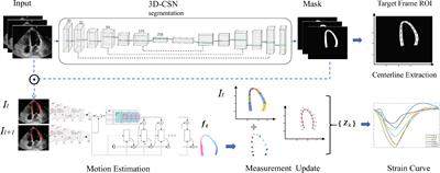 Frontiers | Myocardial strain analysis of echocardiography based on ...