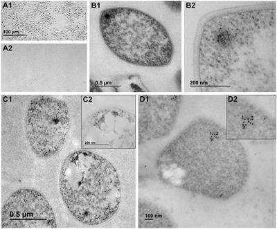 Frontiers | Ultrastructural and proteomic evidence for the presence of ...