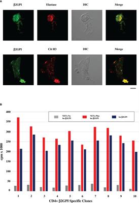 Frontiers | Beta 2 glycoprotein I and neutrophil extracellular traps ...