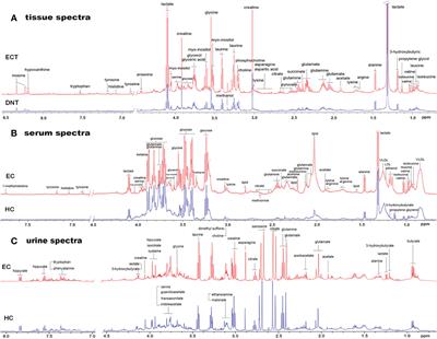 Frontiers | 1H NMR-based metabolomics of paired tissue, serum and urine ...