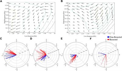 Frontiers | Classifying epileptic phase-amplitude coupling in SEEG ...