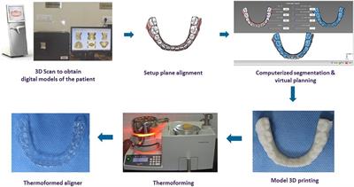 Frontiers | Integrated manufacturing of direct 3D-printed clear aligners