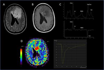 Frontiers | Machine learning decision tree models for multiclass ...