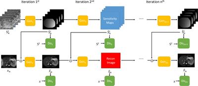 Frontiers | Multi-channel GAN–based calibration-free diffusion-weighted ...