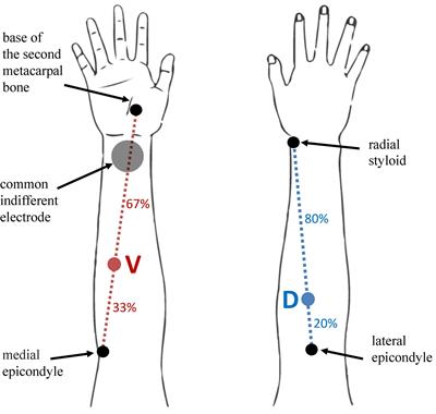 Frontiers | Novel electrotactile brain-computer interface with ...