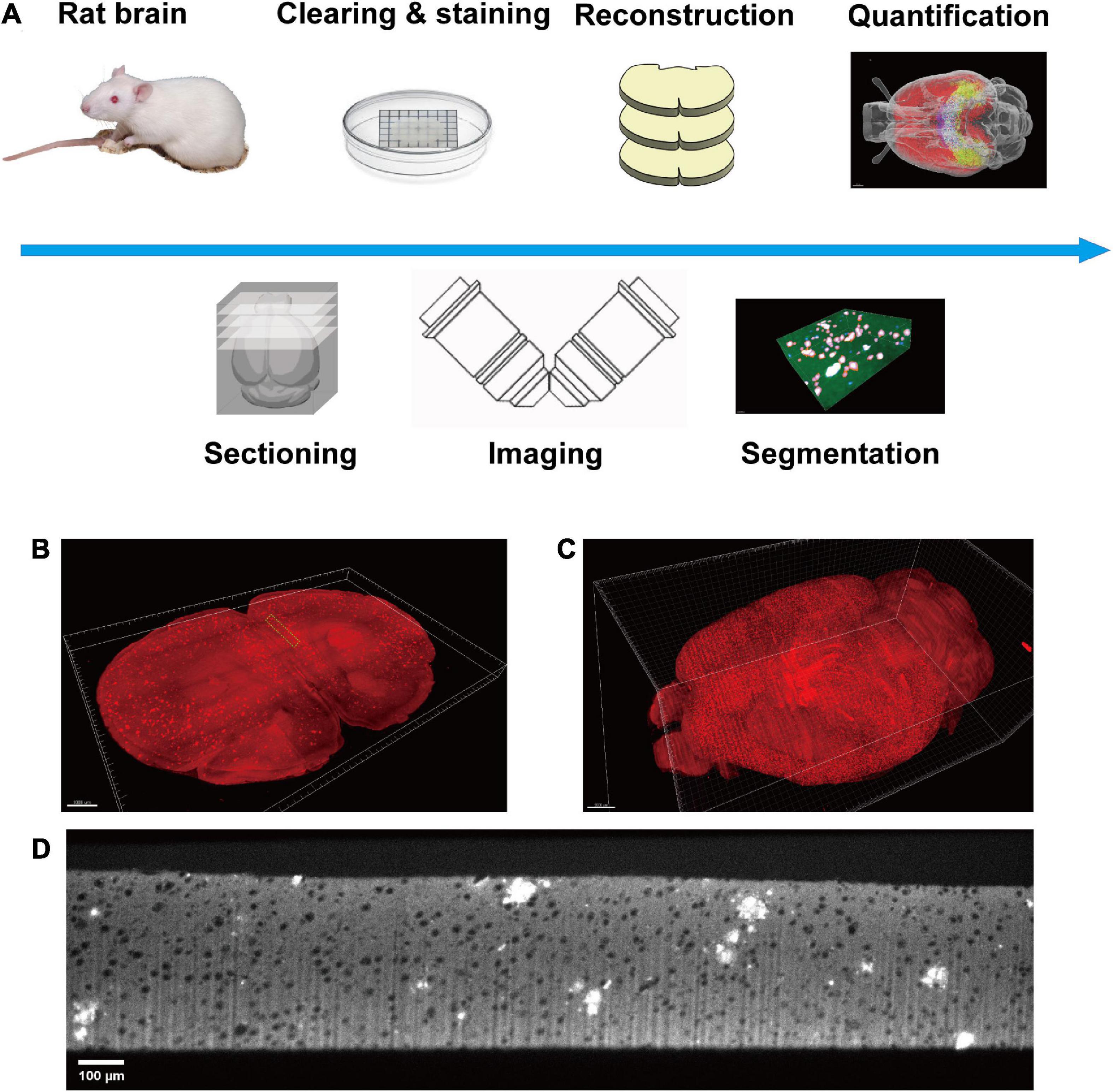 Frontiers | Weakly supervised learning analysis of Aβ plaque ...