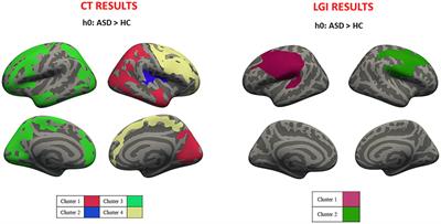 Frontiers | Assessing cortical features in early stage ASD children