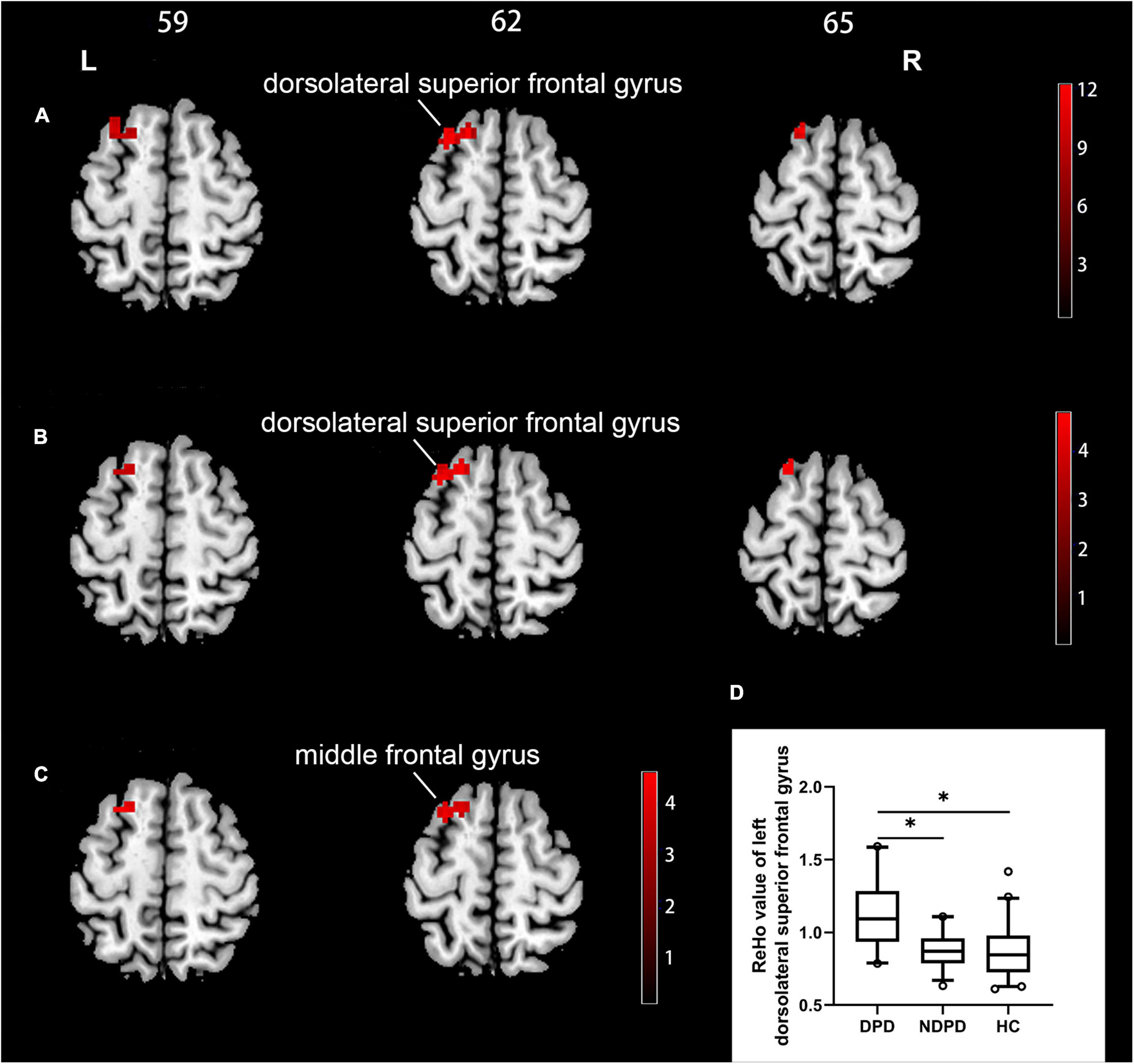 Frontiers | Functional and structural alterations as diagnostic imaging ...