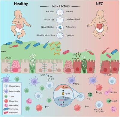 Frontiers | Necrotizing enterocolitis: Bench to bedside approaches and ...