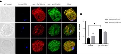 Frontiers | The Gal/GalNac lectin as a possible acetylcholine receptor ...