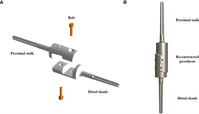 Frontiers | Clinical efficacy of customized modular prosthesis in the ...