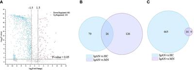 Frontiers | Urinary complement profile in IgA nephropathy and its ...