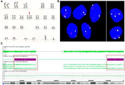 Frontiers | Case report: Detection of fetal trisomy 9 mosaicism by ...