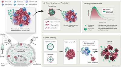 Frontiers | Localized chemotherapy approaches and advanced drug ...