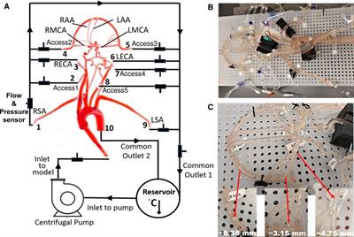 Frontiers | Modeling flow in an in vitro anatomical cerebrovascular ...