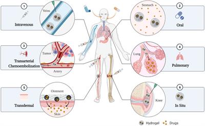 Frontiers | Hydrogel systems for targeted cancer therapy