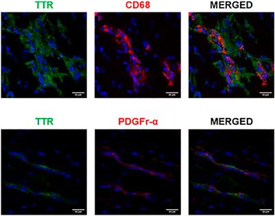 Frontiers | Cellular environment of TTR deposits in an animal model of ...