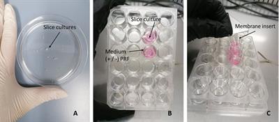 Frontiers | Optimizing culturing conditions in patient derived 3D ...