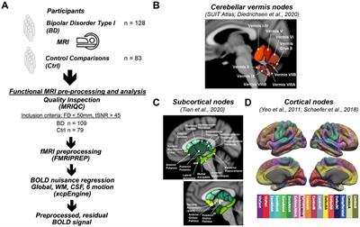 Bipolar Disorder Brain