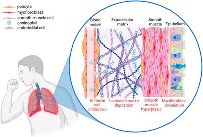 Frontiers | Pericytes: The lung-forgotten cell type