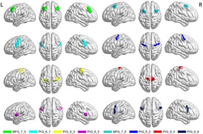 Frontiers | Altered coupling of resting-state cerebral blood flow and ...