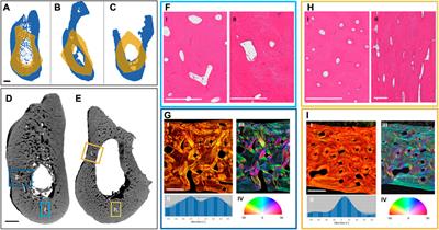 Frontiers | Uncovering the unique characteristics of the mandible to ...
