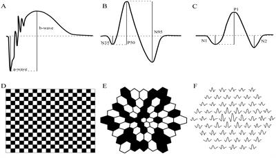 Frontiers | The origins of the full-field flash electroretinogram b-wave