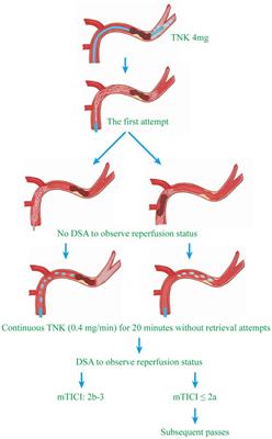 Frontiers | Intra-arterial tenecteplase is safe and may improve the ...