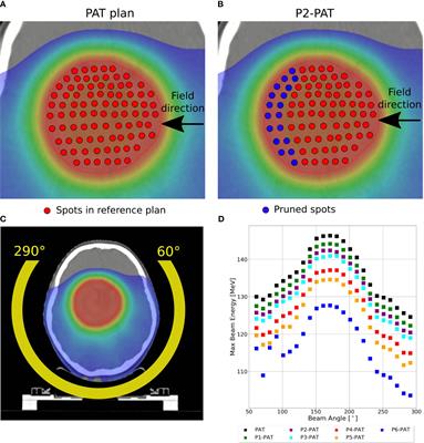 Frontiers | Influence of beam pruning techniques on LET and RBE in ...