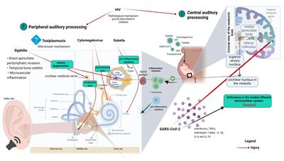 Frontiers | Pathophysiology and mechanisms of hearing impairment ...